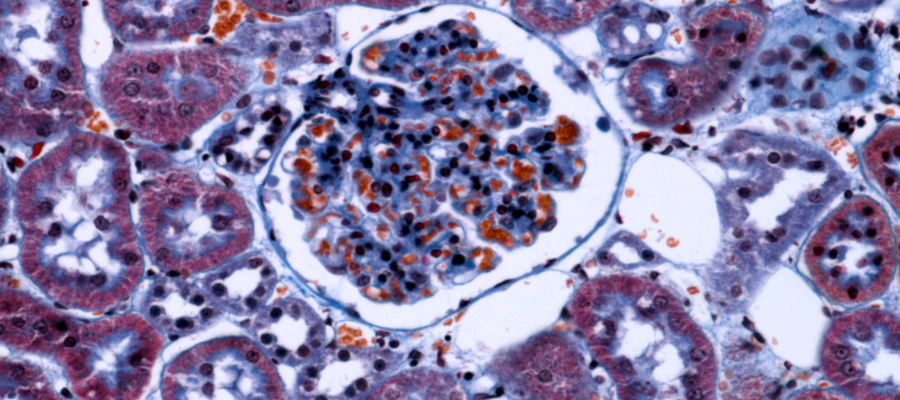 New gene linked to kidney function identified | Generation Scotland